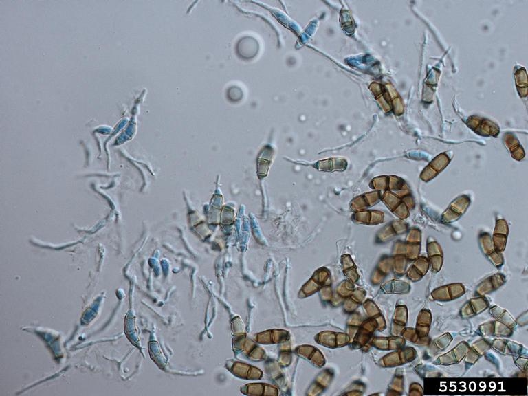 Pestalotiopsis fungus (Pestalotiopsis adusta (Ellis & Everh.) Steyaert)