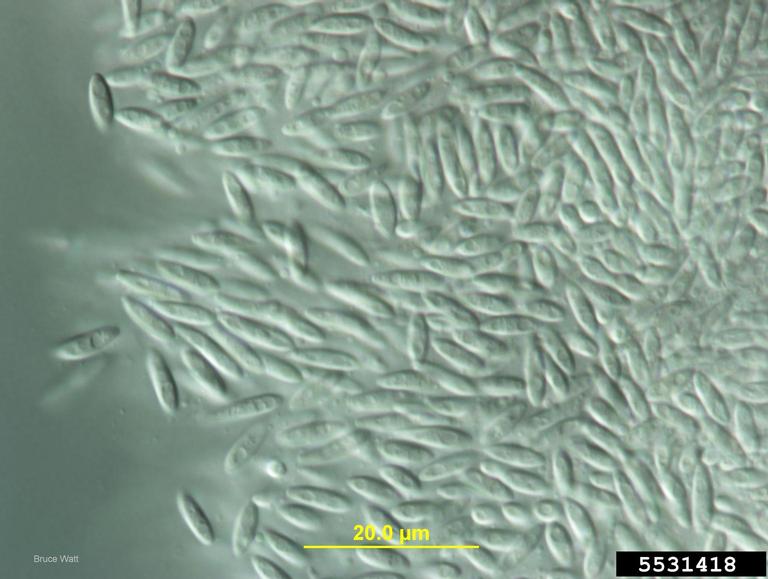 Phomopsis cankers and twig blights (Genus Phomopsis (Sacc.) Bubák)