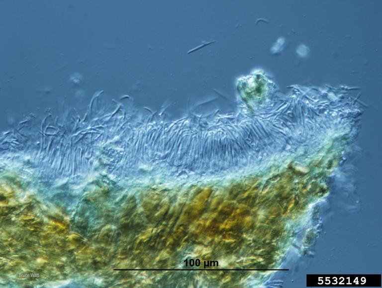 Phomopsis cankers and twig blights (Genus Phomopsis (Sacc.) Bubák)