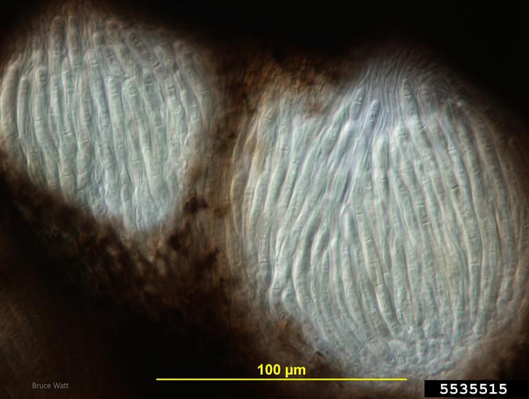 Twig canker (Gibbera vaccinicola M.E. Barr)