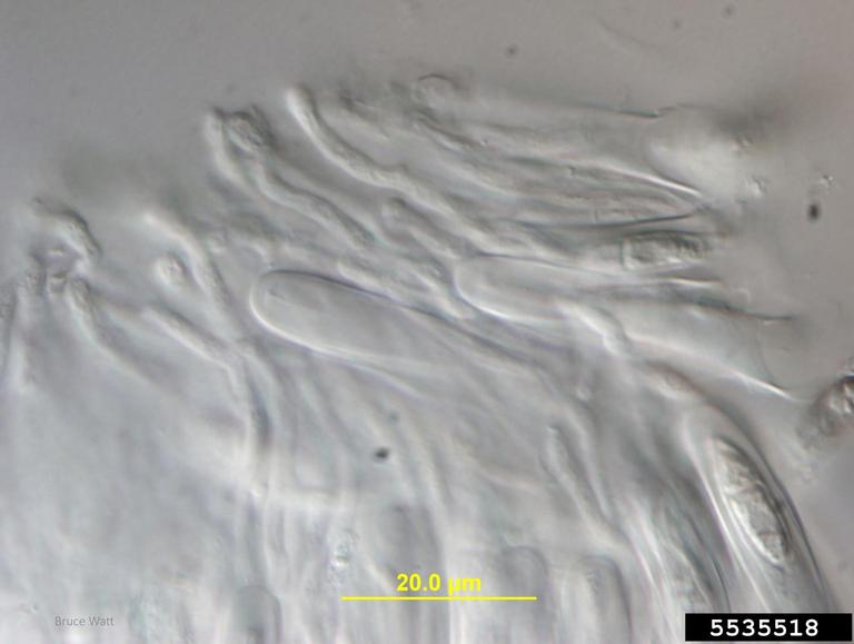 Twig canker (Gibbera vaccinicola M.E. Barr)