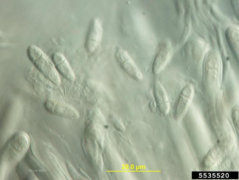 Twig canker (Gibbera vaccinicola M.E. Barr)