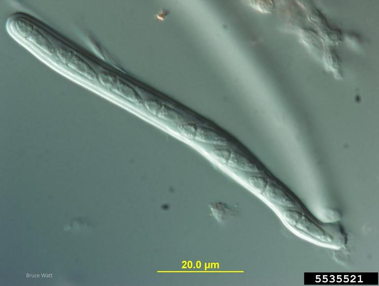 Twig canker (Gibbera vaccinicola ) on highbush blueberry (Vaccinium ...