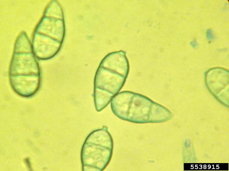 rice blast disease (Genus Pyricularia Sacc.)
