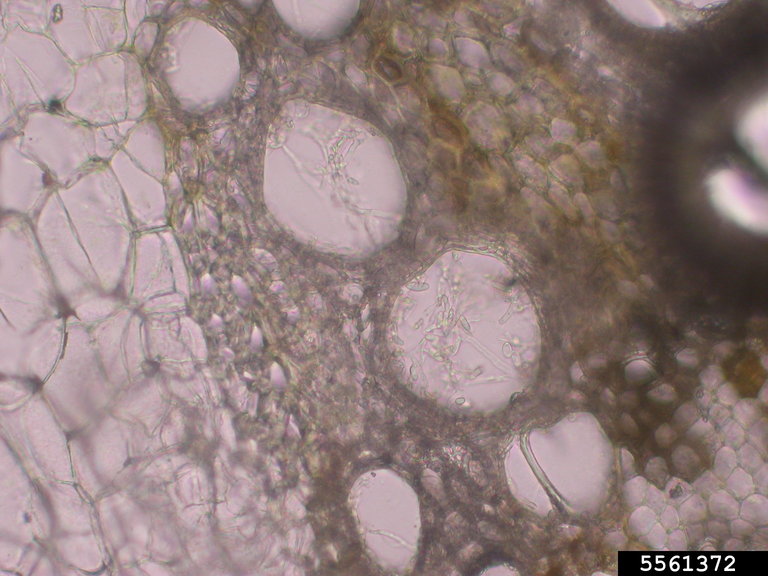Fusarium root rot and wilt (Fusarium oxysporum)