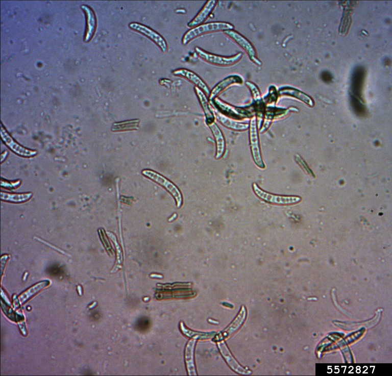chili anthracnose (Colletotrichum capsici (Syd.) E.J. Butler & Bisby)